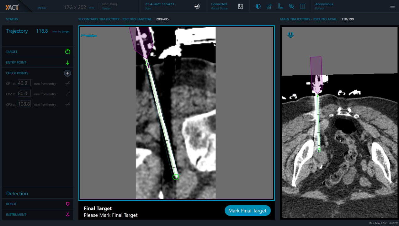 Obturator Lymph Node - XACT