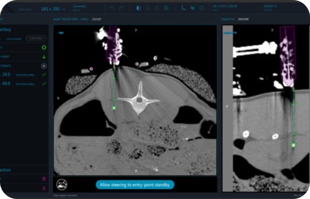 System Overview - XACT