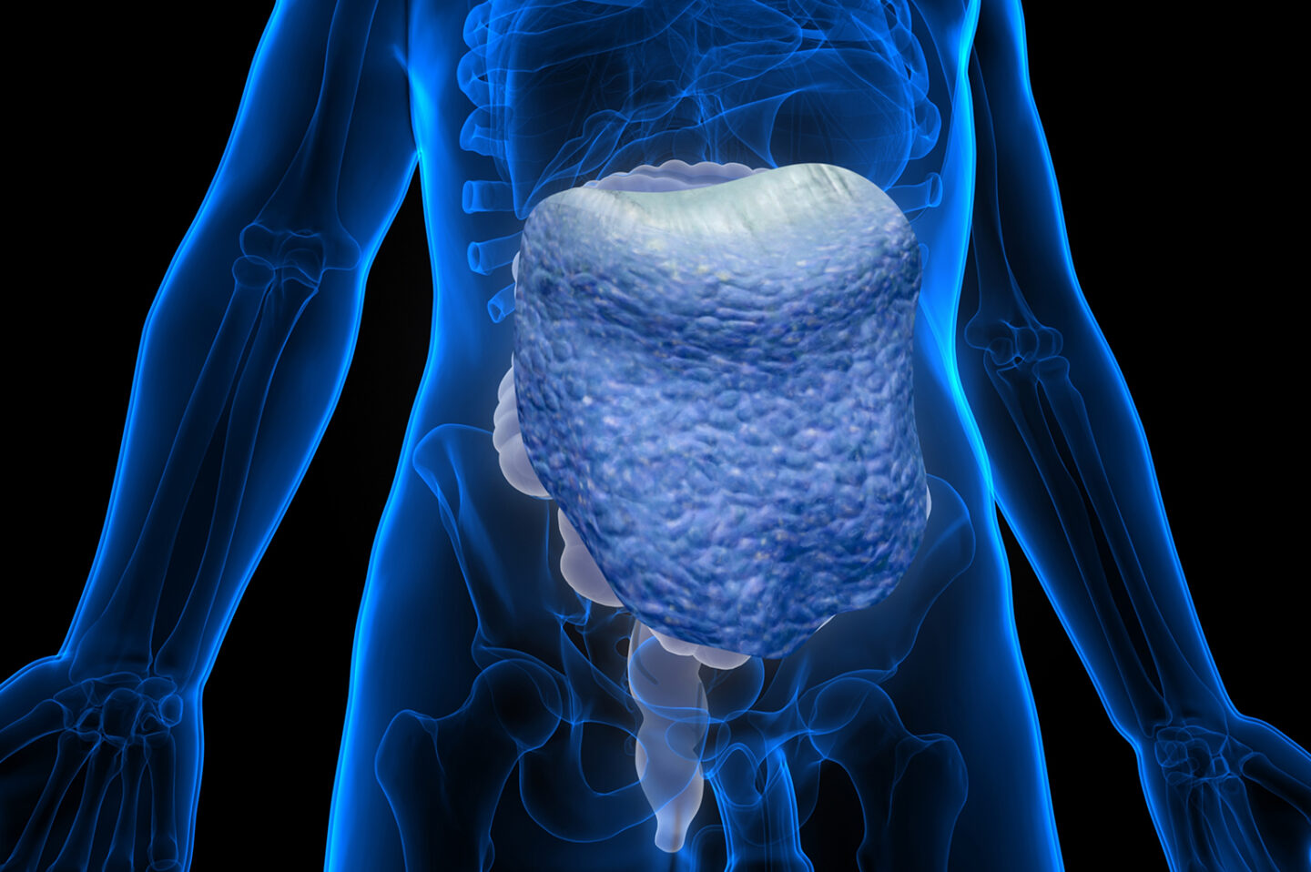 Anatomies - XACT Robotics