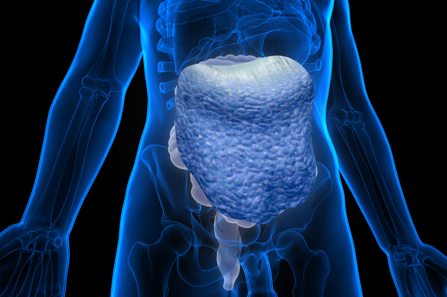 Anatomies - XACT Robotics