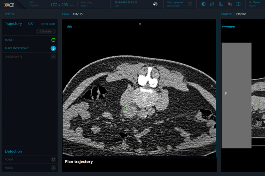 Medical Robotics Technology - XACT Robotics