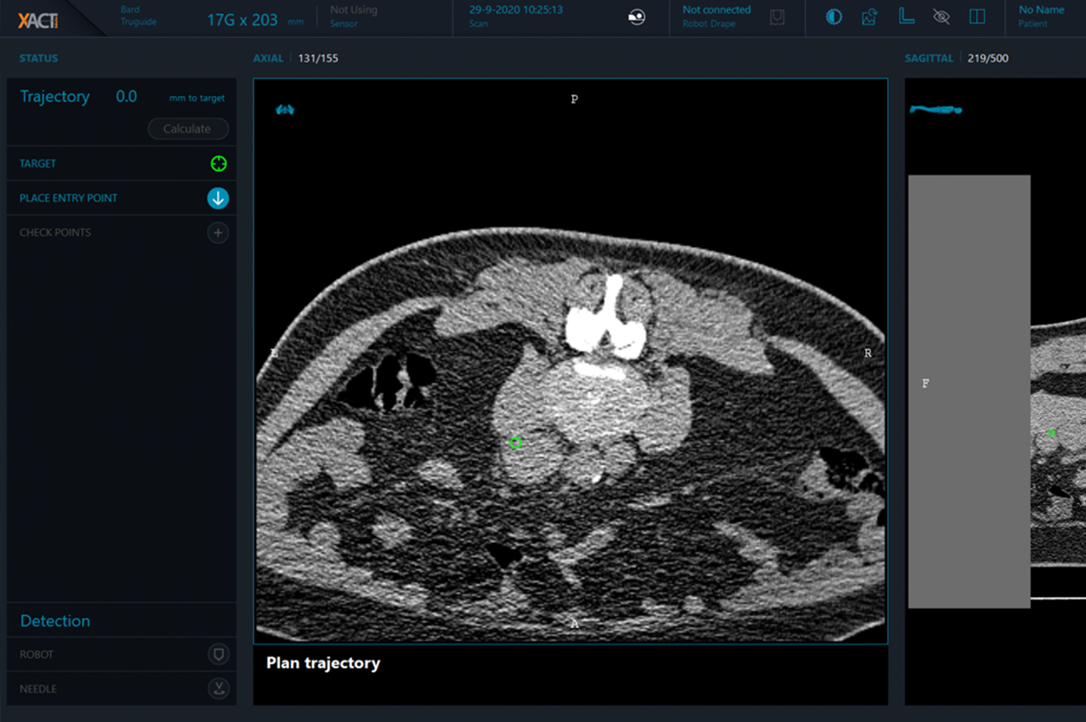 Medical Robotics Technology - XACT Robotics