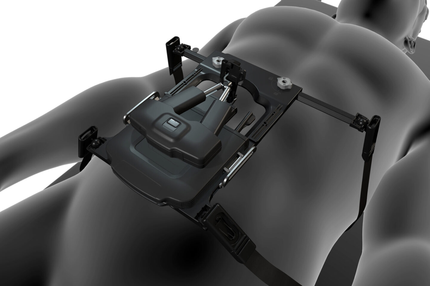 Medical Robotics Technology - XACT Robotics